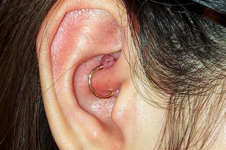 Why You are Getting a Piercing Bump